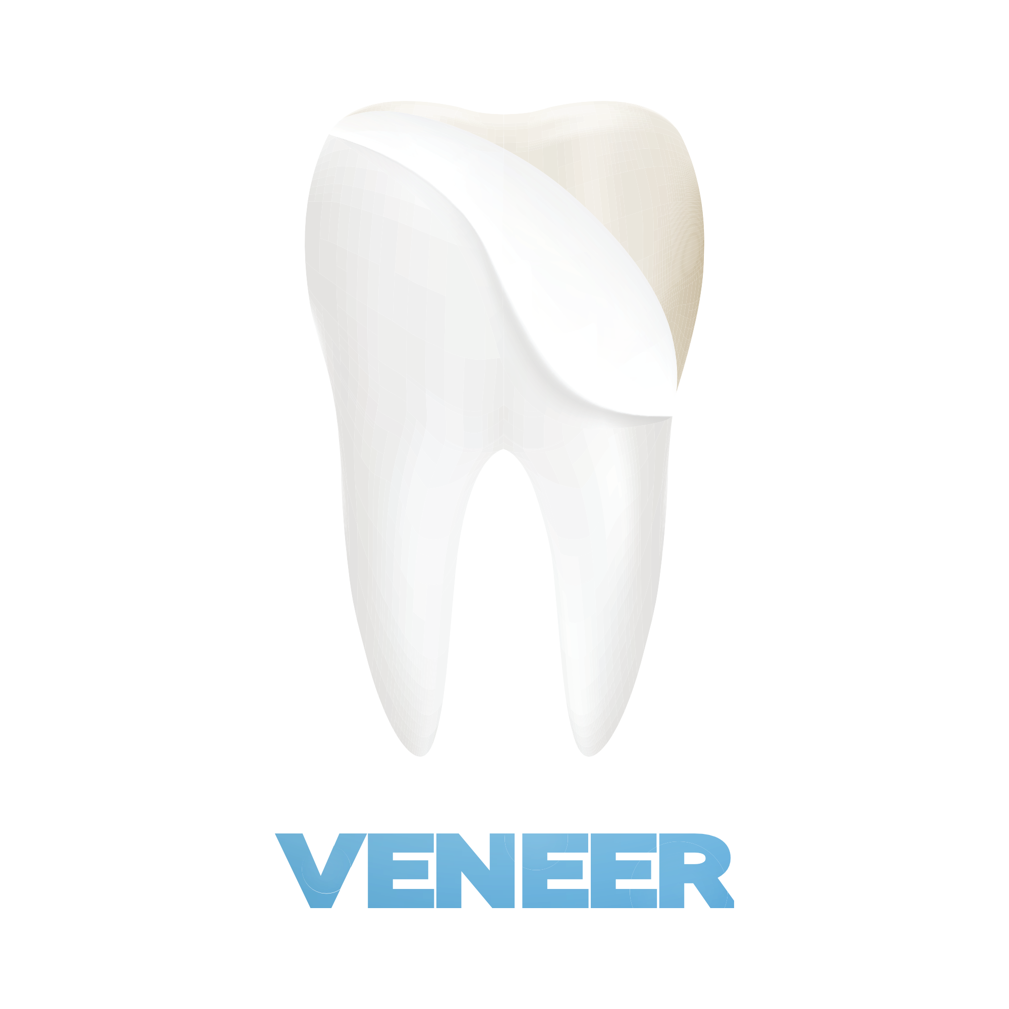 Veneers - Fakten, Vorteile & 12 FAQs